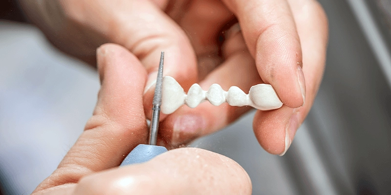 Can You Get a Same-Day Dental Bridge? What to Expect - Smile Lab